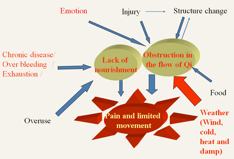 Geelong Chinese Pain & Headache Medicine - Geelong Chinese Medicine Clinic