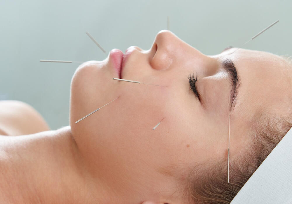 Cosmetic Acupuncture - Geelong Chinese Medicine Clinic